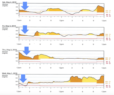 Dissecting CGM Downloads - Taking Control Of Your Diabetes®