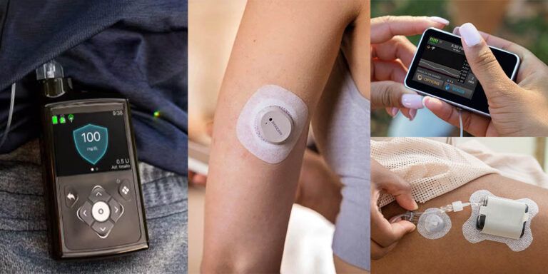 8 Diabetes Device Hacks to Optimize Your CGM & Insulin Pump