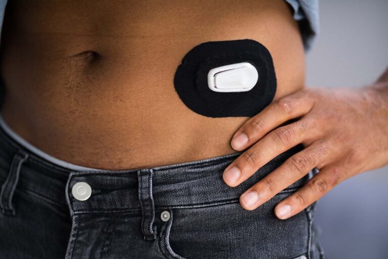 8 Diabetes Device Hacks to Optimize Your CGM & Insulin Pump