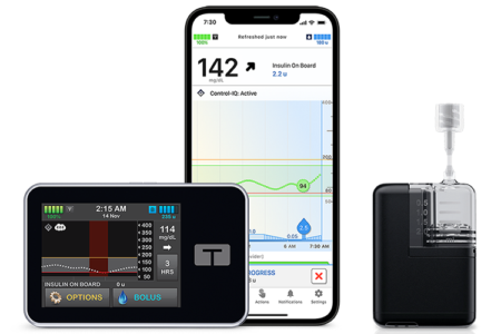 Automated Insulin Delivery Systems: A Complete Guide