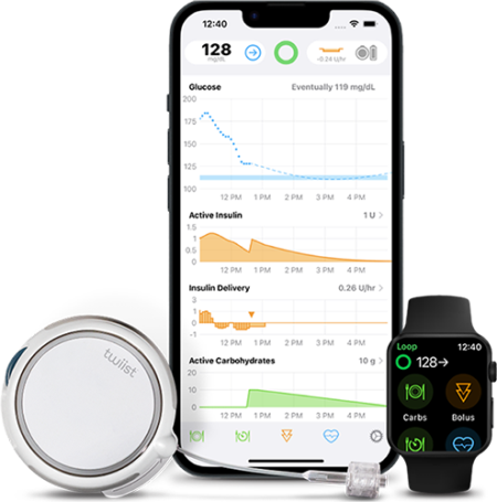 Automated Insulin Delivery Systems: A Complete Guide